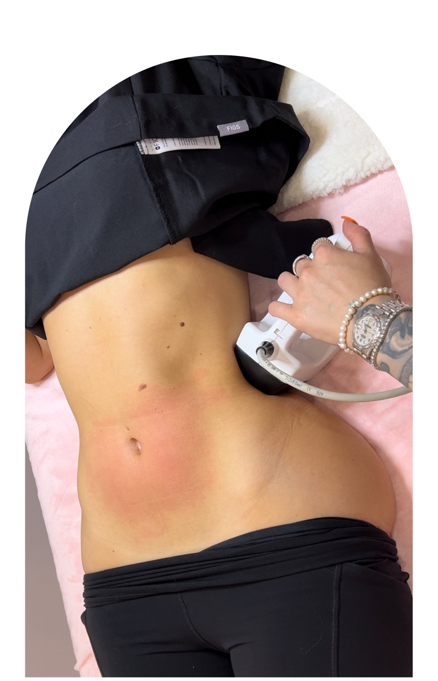 BodyFX Contouring Treatment: The solution for your body goals | MY SKIN SPOT